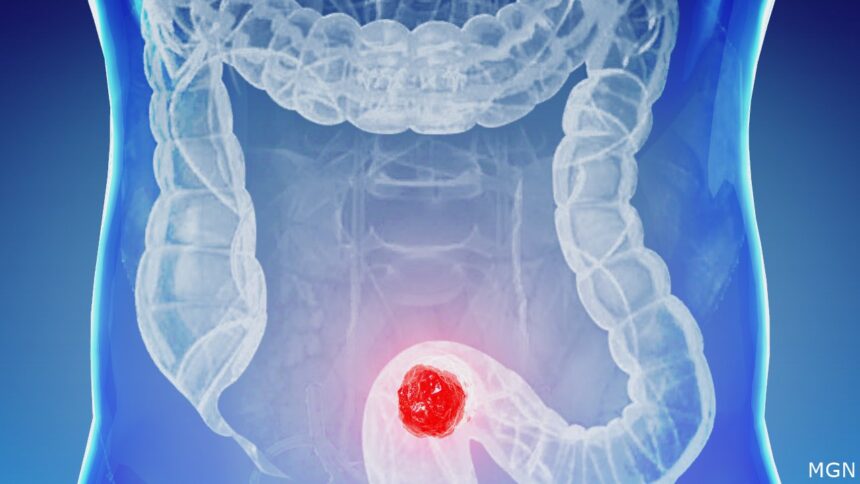 Colonoscopies may not reduce cancer deaths, study finds, but experts ... Colonoscopies may not reduce cancer deaths, study finds, but experts ...